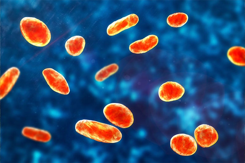 Understanding sepsis | Kaweah Health